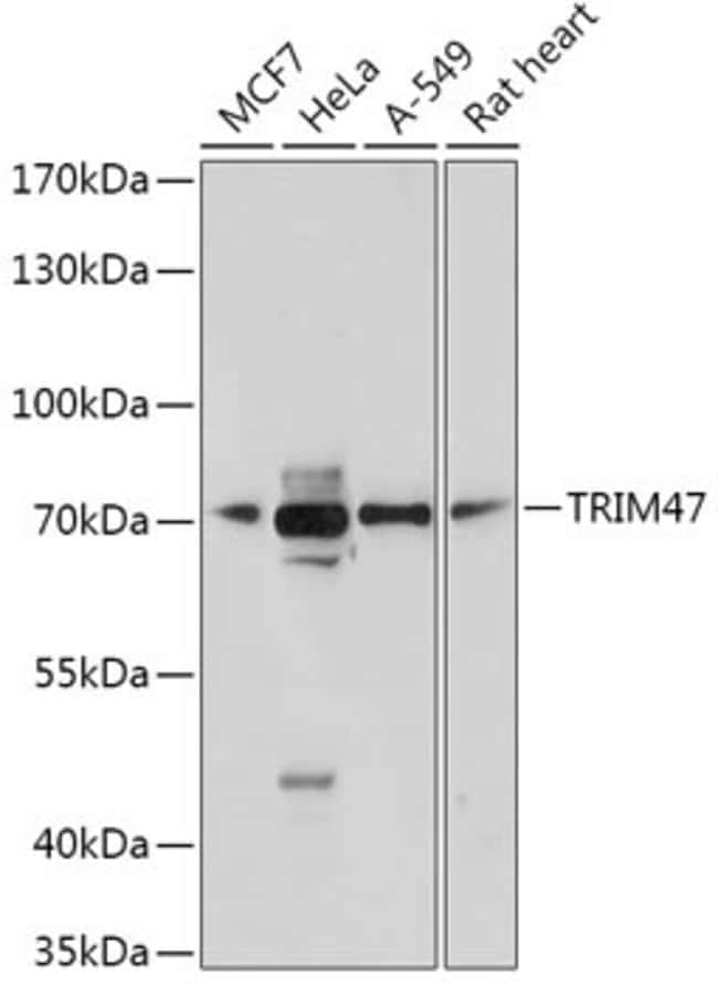 TRIM47 Polyclonal Antibody, Invitrogen 100 μL; Unconjugated:Antibodies ...