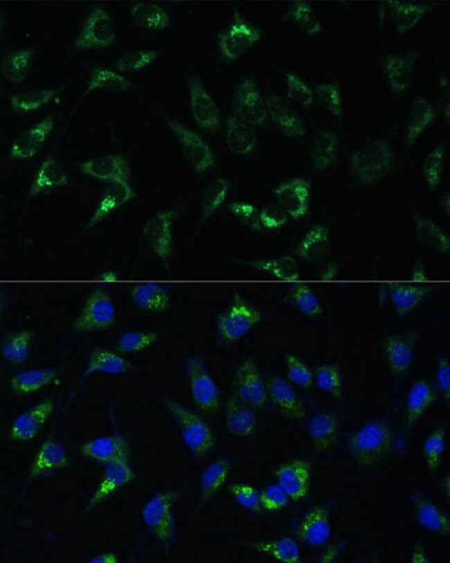 USP46 Rabbit anti-Human, Mouse, Rat, Unconjugated, Polyclonal ...