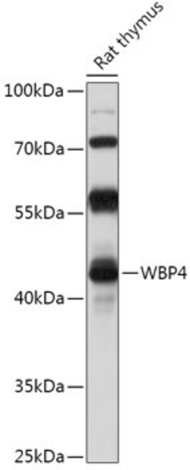 WBP4 Rabbit anti-Human, Rat, Unconjugated, Polyclonal, Invitrogen 100 ...