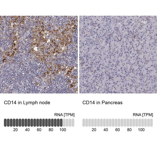 CD14 Polyclonal Antibody, Invitrogen 100 μL; Unconjugated:Antibodies ...