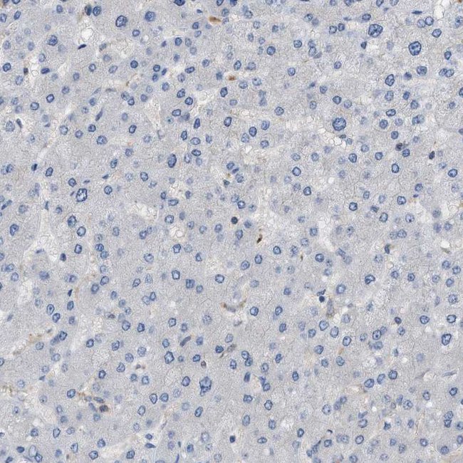Cystatin B Rabbit anti-Human, Unconjugated, Polyclonal, Invitrogen 100 ...