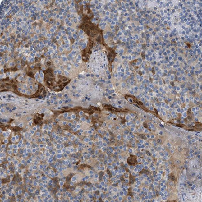 Cystatin B Rabbit anti-Human, Unconjugated, Polyclonal, Invitrogen 100 ...