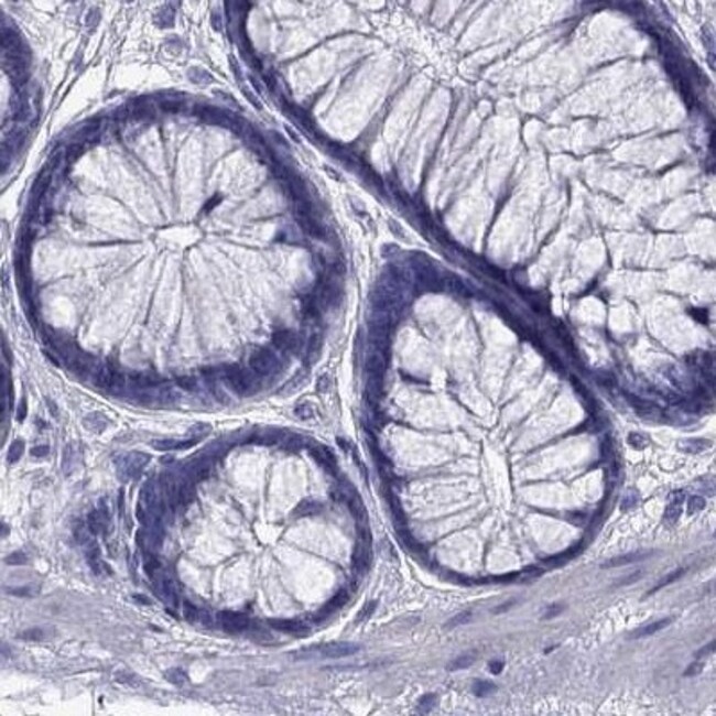Invitrogen PSMB11 Polyclonal Antibody 100 μL | Buy Online | Invitrogen ...