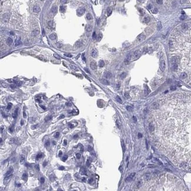 Invitrogen PSMB11 Polyclonal Antibody 100 μL | Buy Online | Invitrogen ...