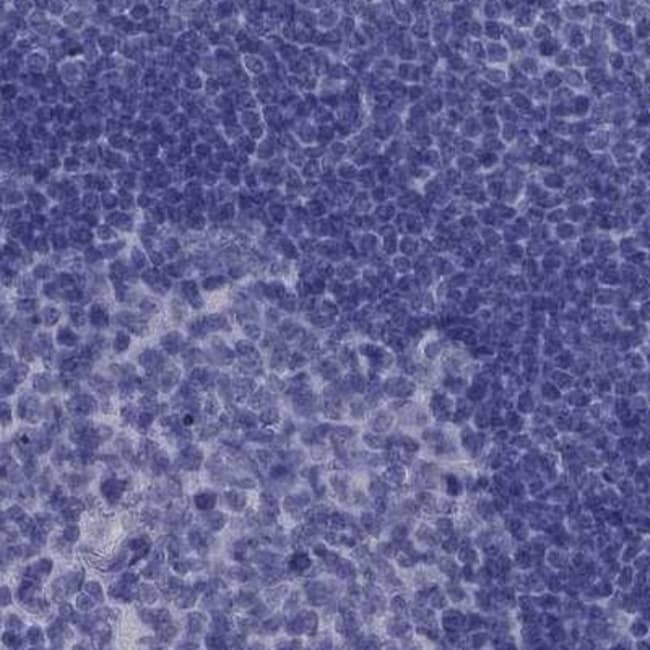 Invitrogen PSMB11 Polyclonal Antibody 100 μL | Buy Online | Invitrogen ...