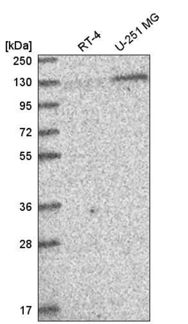 PUM2 Polyclonal Antibody, Invitrogen 100 μL; Unconjugated:Antibodies ...