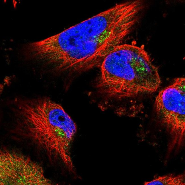 USP8 Polyclonal Antibody, Invitrogen 100 μL; Unconjugated:Antibodies ...
