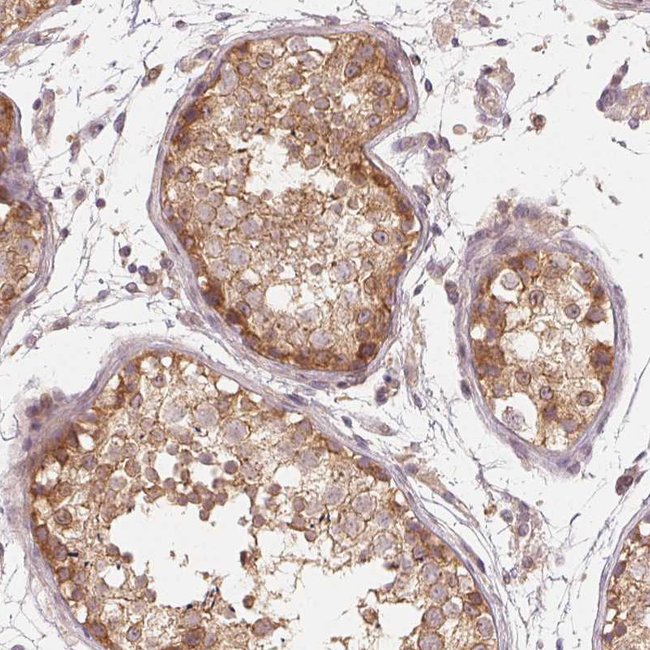 USP8 Polyclonal Antibody, Invitrogen 100 μL; Unconjugated:Antibodies ...