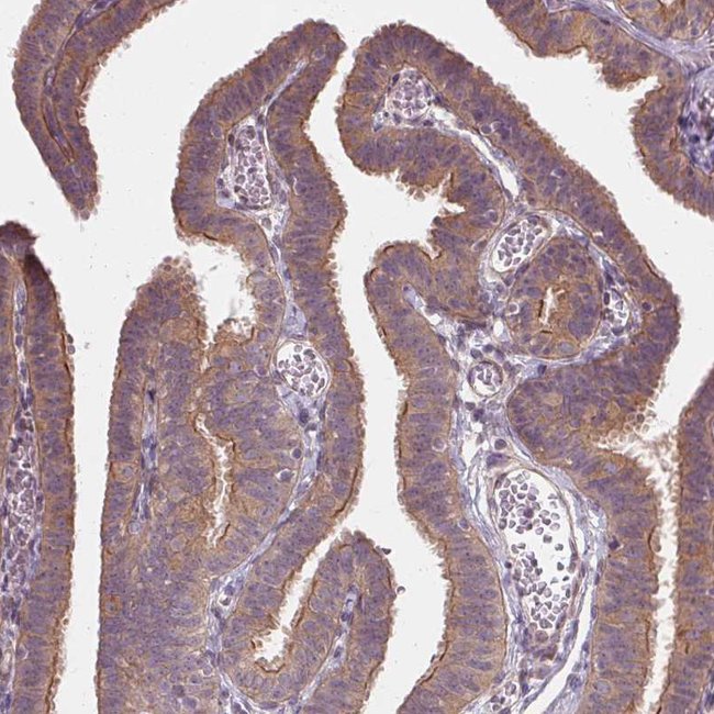 USP8 Polyclonal Antibody, Invitrogen 100 μL; Unconjugated:Antibodies ...