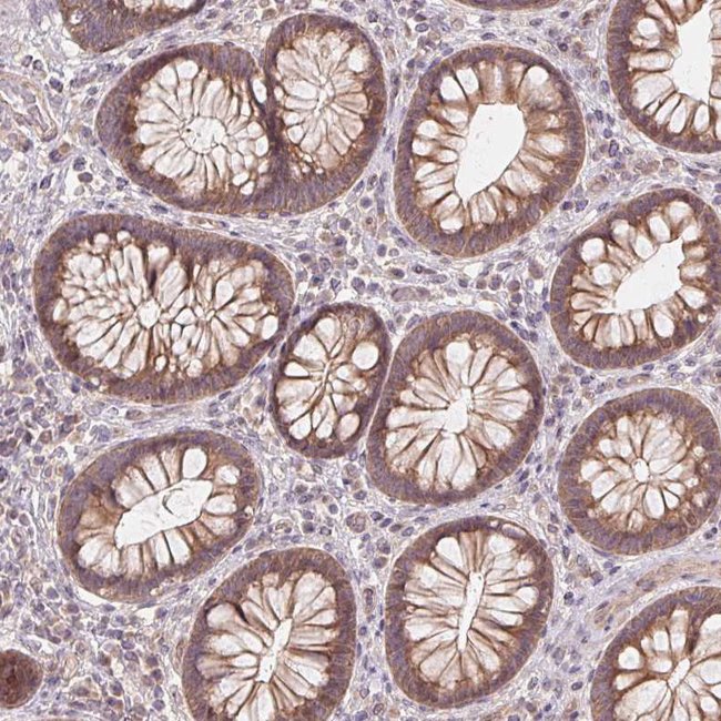 USP8 Polyclonal Antibody, Invitrogen 100 μL; Unconjugated:Antibodies ...