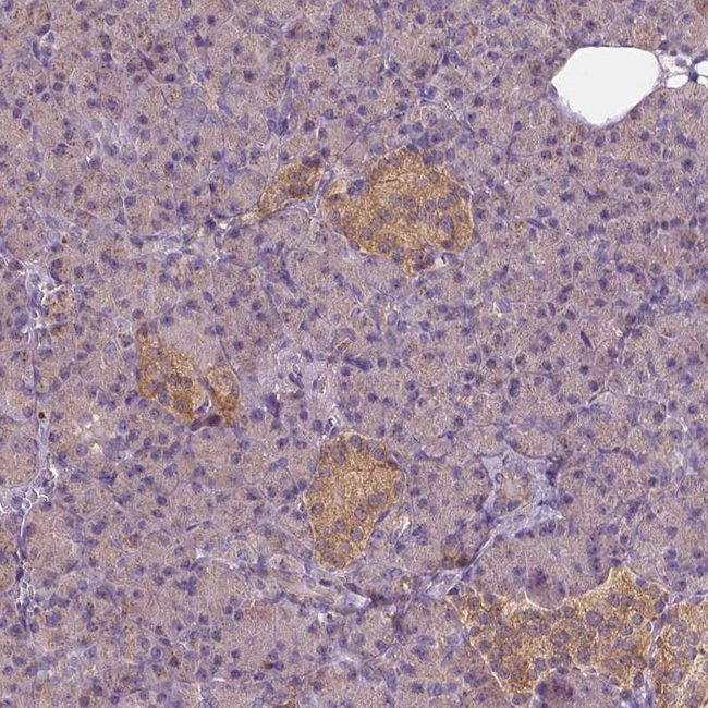 GPRC5D Polyclonal Antibody, Invitrogen 100 μL; Unconjugated:Antibodies ...