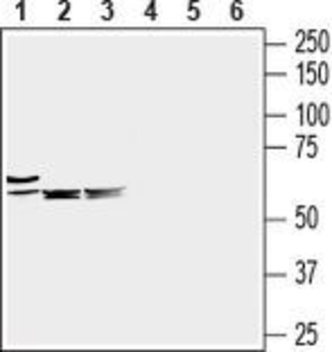 SLC6A8 Rabbit anti-Human, Mouse, Rat, Unconjugated, Polyclonal ...