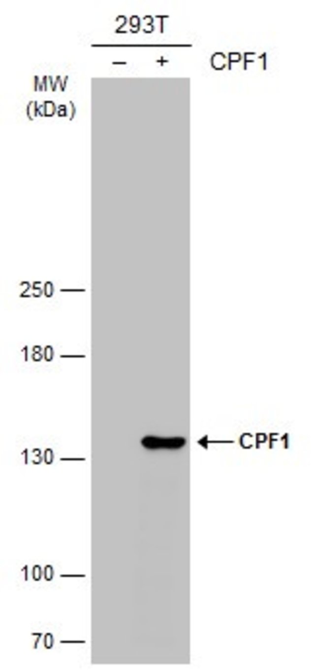 Invitrogen CPF1 Polyclonal Antibody 100 μL | Buy Online | Invitrogen ...