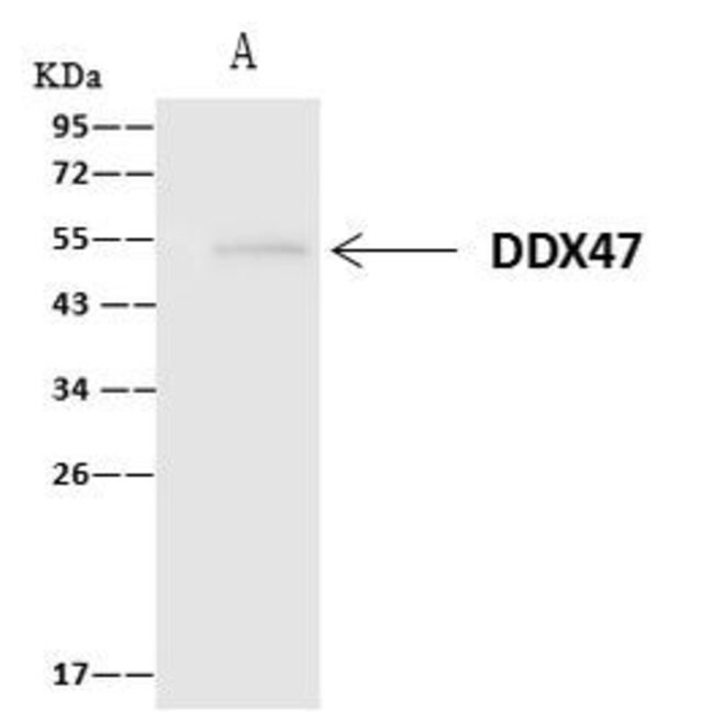 DDX47 Rabbit anti-Human, Polyclonal, Invitrogen 100 μL; Unconjugated ...