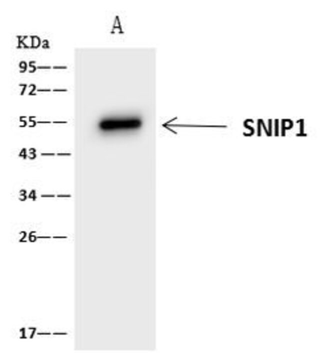 SNIP1 Polyclonal Antibody, Invitrogen 100 μL; Unconjugated:Antibodies ...