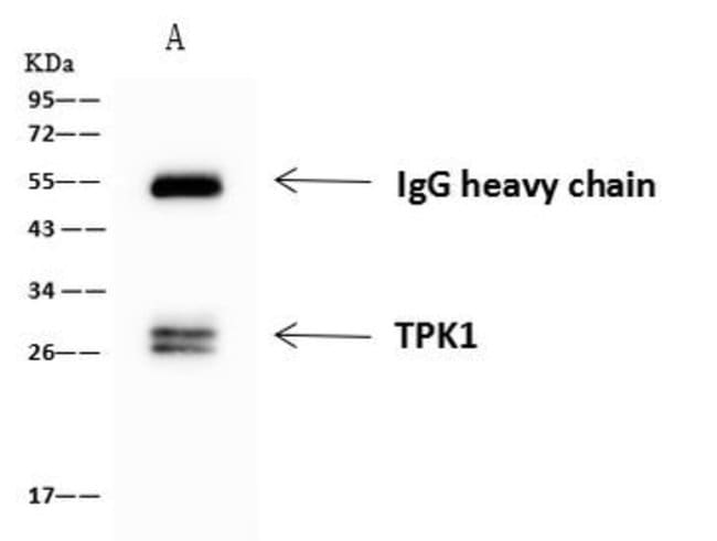 TPK1 Rabbit anti-Human, Polyclonal, Invitrogen 100 μL; Unconjugated ...