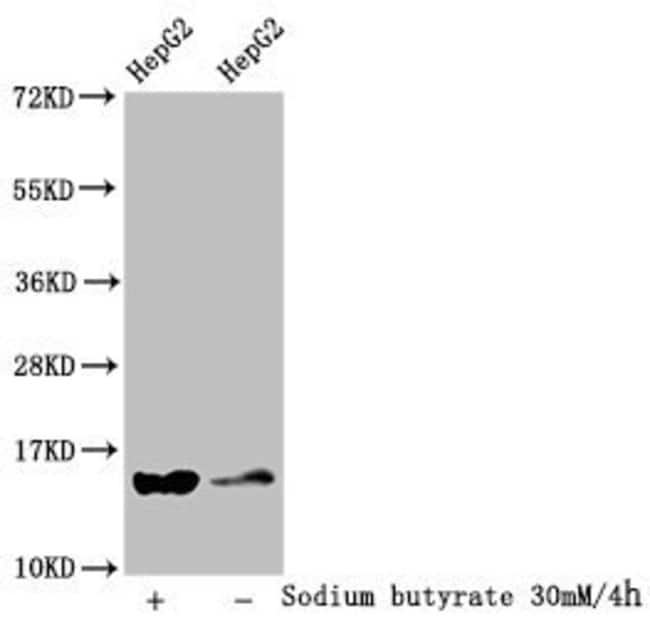 Formyl-Histone Macro-H2A.1 (Lys118) Polyclonal Antibody, Invitrogen 100 ...