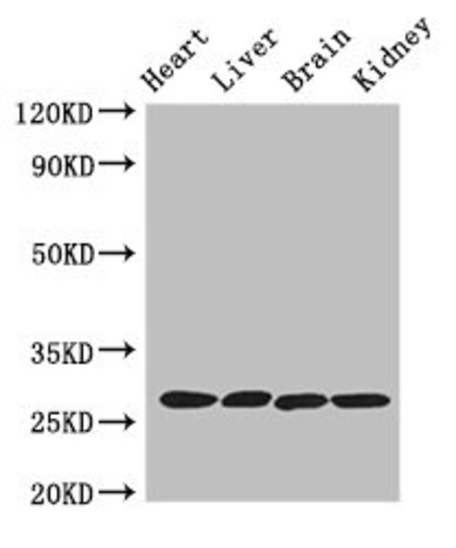 Trypsin 2 Polyclonal Antibody, Invitrogen 100 μg; Unconjugated ...