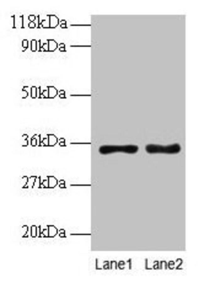 PTDSS1 Polyclonal Antibody, Invitrogen 100 μg; Unconjugated:Antibodies ...