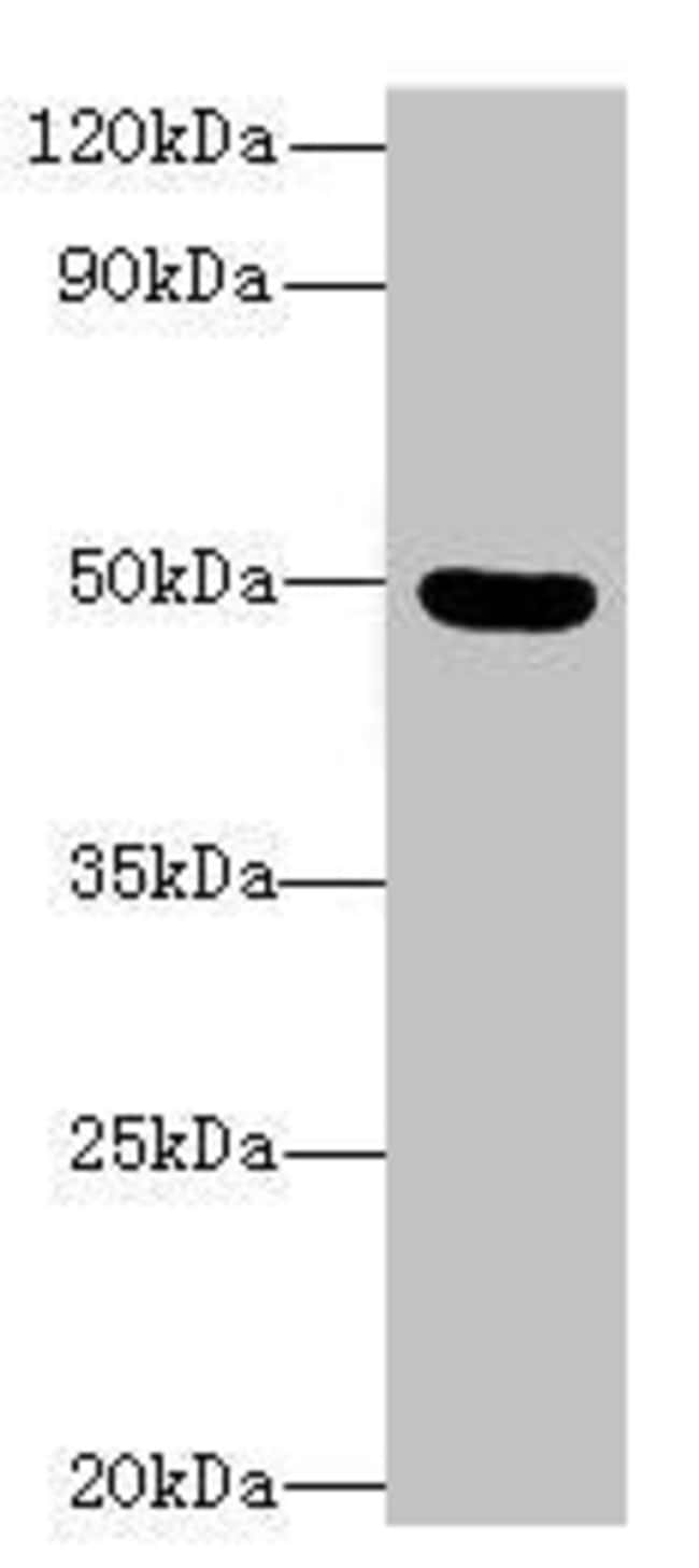C5orf22 Rabbit anti-Human, Mouse, Polyclonal, Invitrogen 100 μg ...