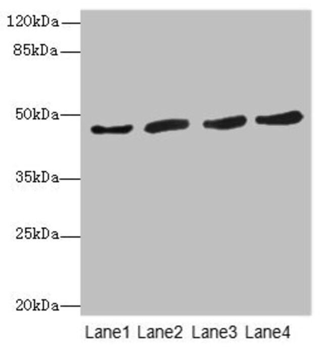 NORE1 Rabbit anti-Human, Polyclonal, Invitrogen 100 μL; Unconjugated ...
