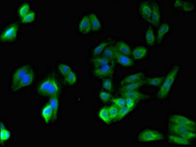 SPPL3 Polyclonal Antibody, Invitrogen 100 μg; Unconjugated:Antibodies ...