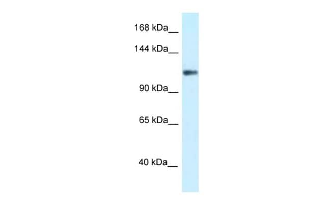 KCNH3 Rabbit anti-Human, Polyclonal, Invitrogen 100 μL; Unconjugated ...