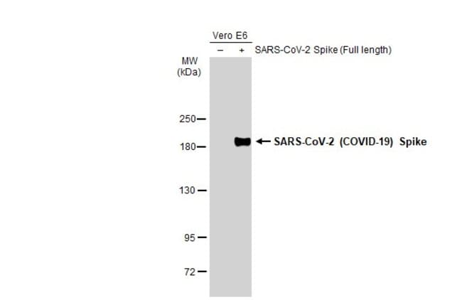 Invitrogen SARS-CoV-2 Spike Protein (RBD) Polyclonal Antibody 100 μL; | Fisher Scientific