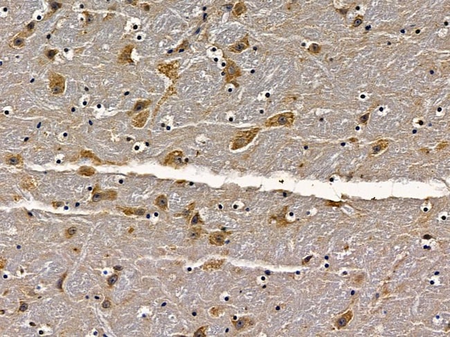 Invitrogen CDYL Polyclonal Antibody 100 μL; Unconjugated:Antibodies ...