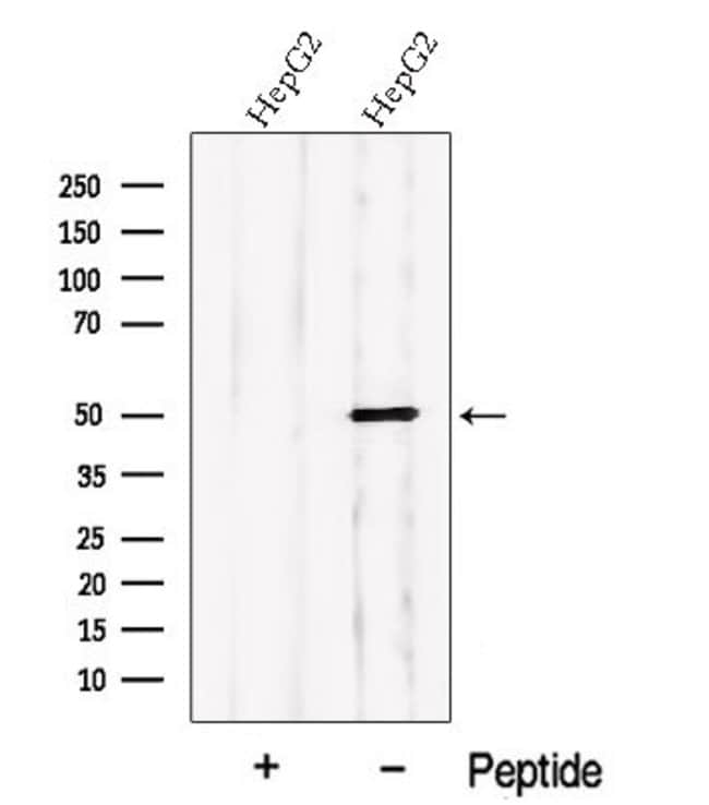 Invitrogen PDE7B Polyclonal Antibody 100 μL; Unconjugated:Antikroppar ...