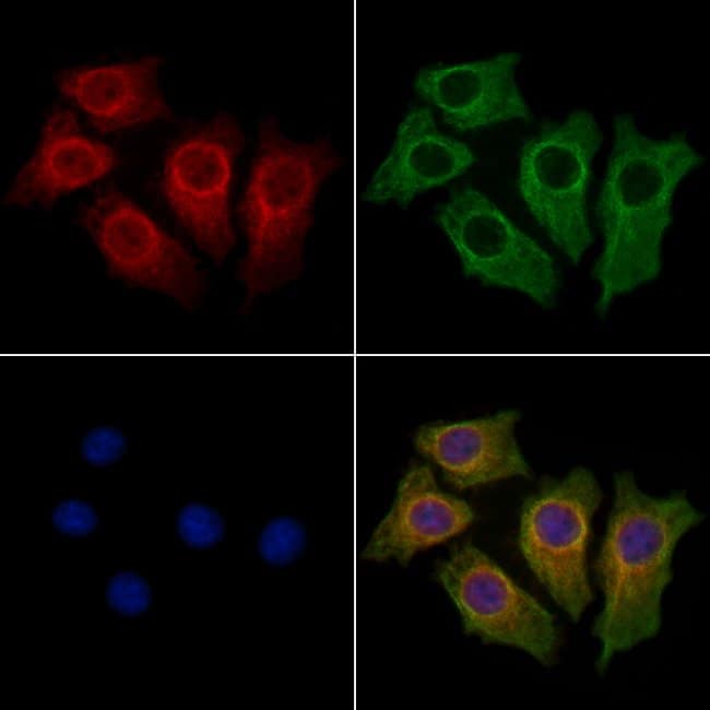 Invitrogen TCHH Polyclonal Antibody 100 μL; Unconjugated:Antibodies ...