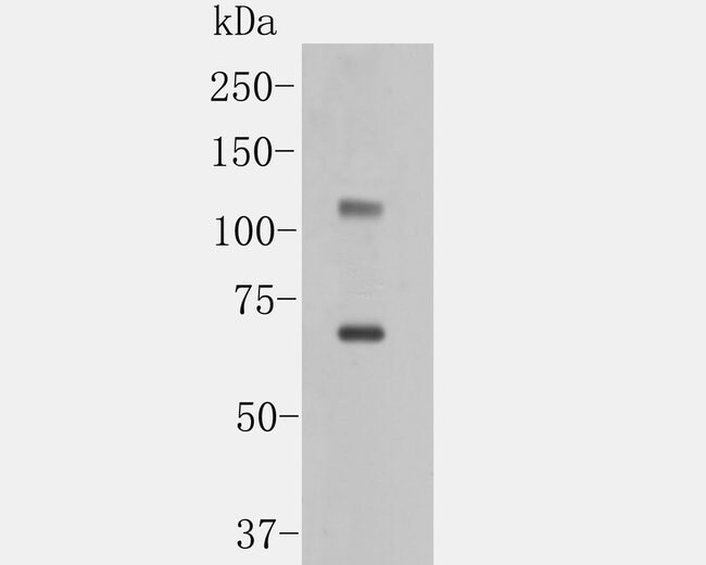 Invitrogen ACE2 Polyclonal Antibody 100 μL; Unconjugated:Antibodies ...
