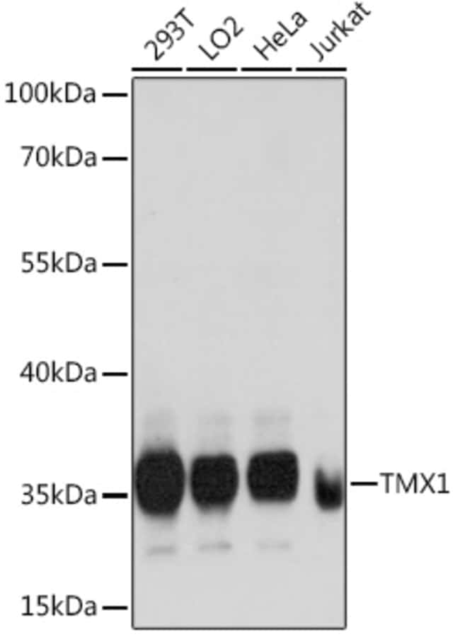 Invitrogen TMX Polyclonal Antibody 100 μL; Unconjugated:Antikroppar ...