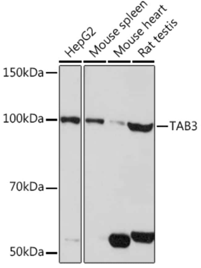 Invitrogen TAB3 Polyclonal Antibody 100 μL; Unconjugated:Antikroppar ...