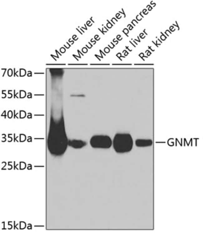 Invitrogen GNMT Polyclonal Antibody 100 μL; Unconjugated:Antikroppar | Fisher Scientific