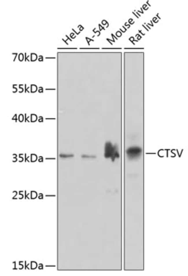 Invitrogen Cathepsin V Polyclonal Antibody 100 μL; Unconjugated ...