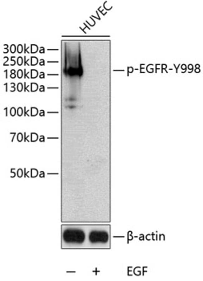 Invitrogen Phospho-EGFR (Tyr998) Polyclonal Antibody 100 μL; Unconjugated:Antibodies, | Fisher ...