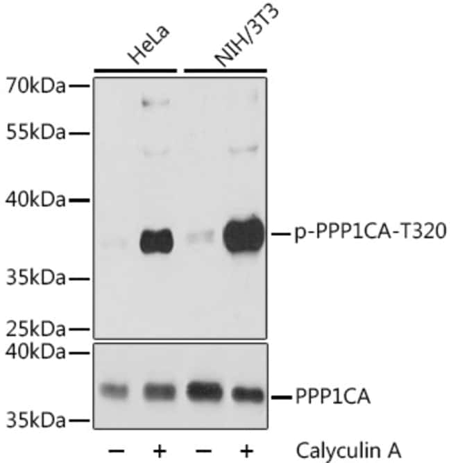 Invitrogen Phospho-PP1 alpha (Thr320) Polyclonal Antibody 100 μL | Buy ...