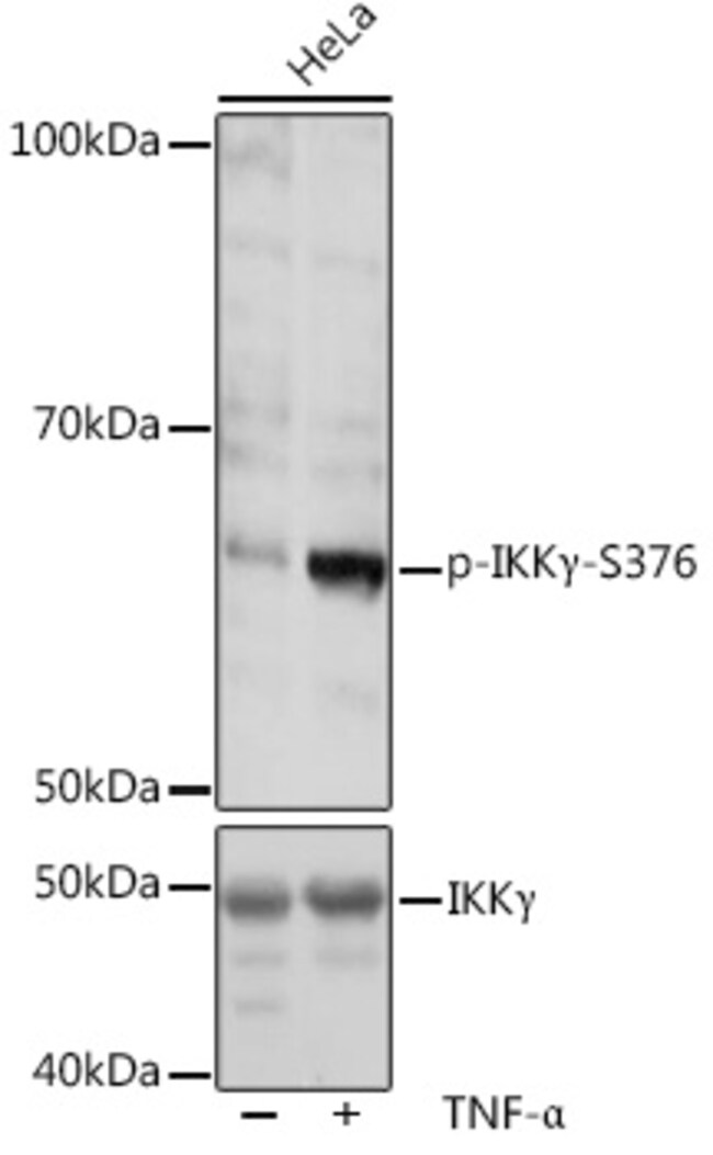Invitrogen Phospho-IKK gamma (Ser376) Polyclonal Antibody 100 μL; Unconjugated:Antikroppar ...