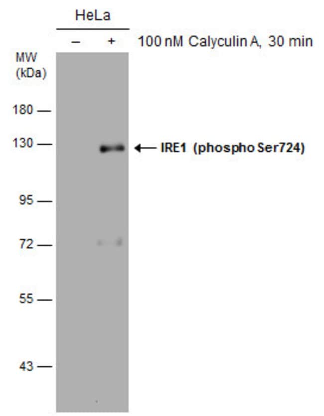 Phospho-IRE1 alpha (Ser724) Polyclonal Antibody, Invitrogen 100 μL ...