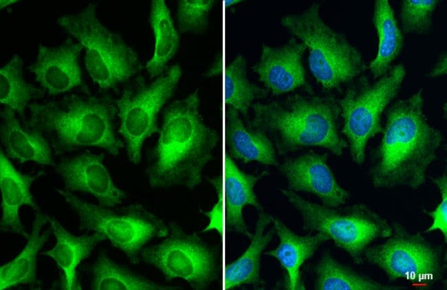 Invitrogen HPV Type 18 E7 Polyclonal Antibody 100 μL; Unconjugated ...