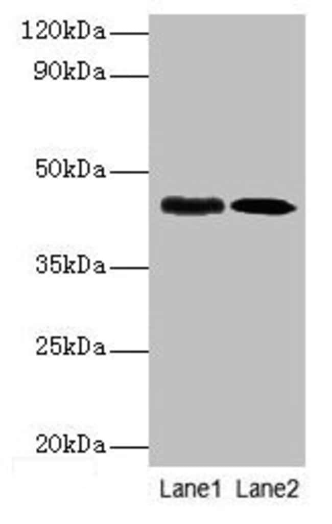 Invitrogen E. coli lapB Polyclonal Antibody 100 μg; Unconjugated ...