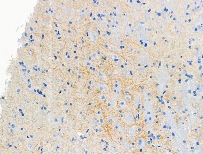 Phospho-MBP (Thr232) Polyclonal Antibody, Invitrogen™ 100 μL ...