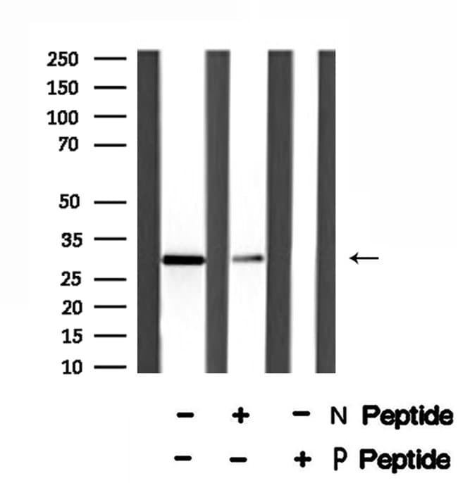 Phospho-MBP (Thr232) Polyclonal Antibody, Invitrogen™ 100 μL ...