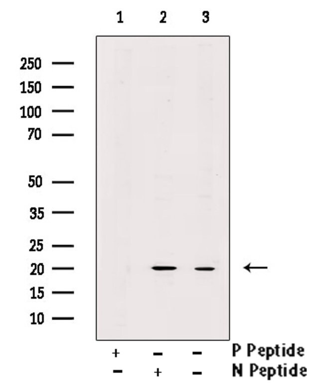 Phospho-MBP (Thr232) Polyclonal Antibody, Invitrogen™ 100 μL ...