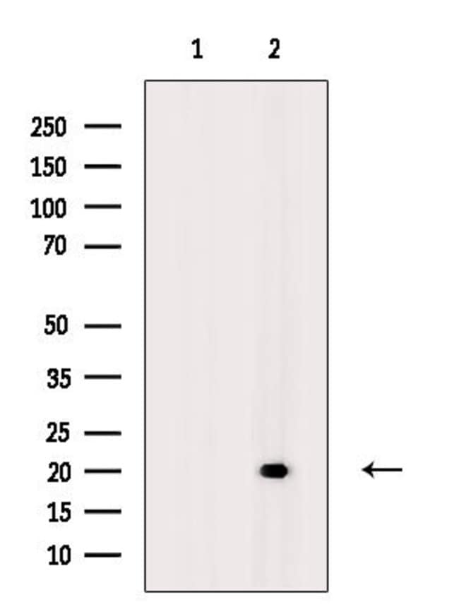 Phospho-MBP (Thr232) Polyclonal Antibody, Invitrogen™ 100 μL ...
