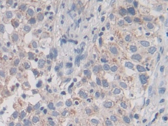 ABCA3 Polyclonal Antibody, Invitrogen 20 μL; Unconjugated:Antibodies ...