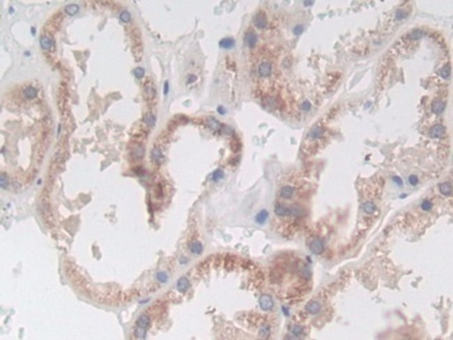 ABCA3 Polyclonal Antibody, Invitrogen 20 μL; Unconjugated:Antibodies ...