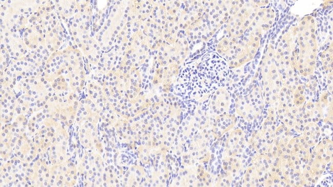 CREG1 Polyclonal Antibody, Invitrogen 20 μL; Unconjugated:Antibodies ...