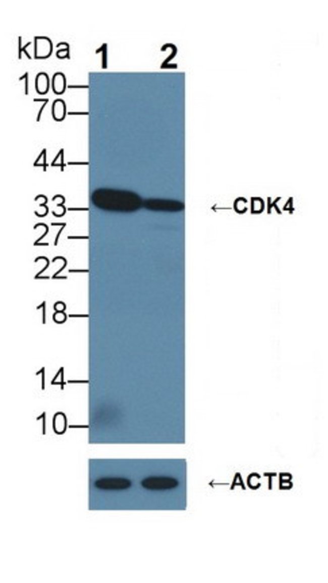 Invitrogen CDK4 Polyclonal Antibody:Antibodies:Primary Antibodies | Fisher Scientific